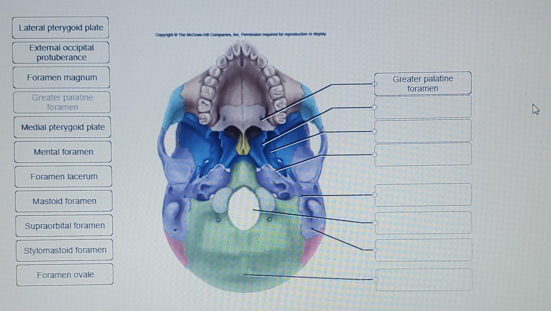 Medial And Lateral Pterygoid Plates