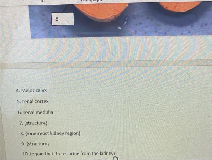 Solved 4. Major calyx 5. renal cortex Kidney Model | Chegg.com