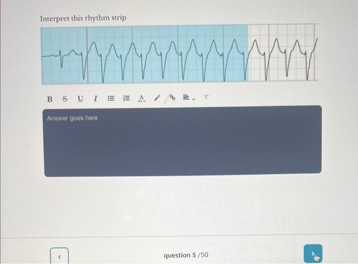 Solved Interpret this rhythm strip Interpret this rhythm | Chegg.com