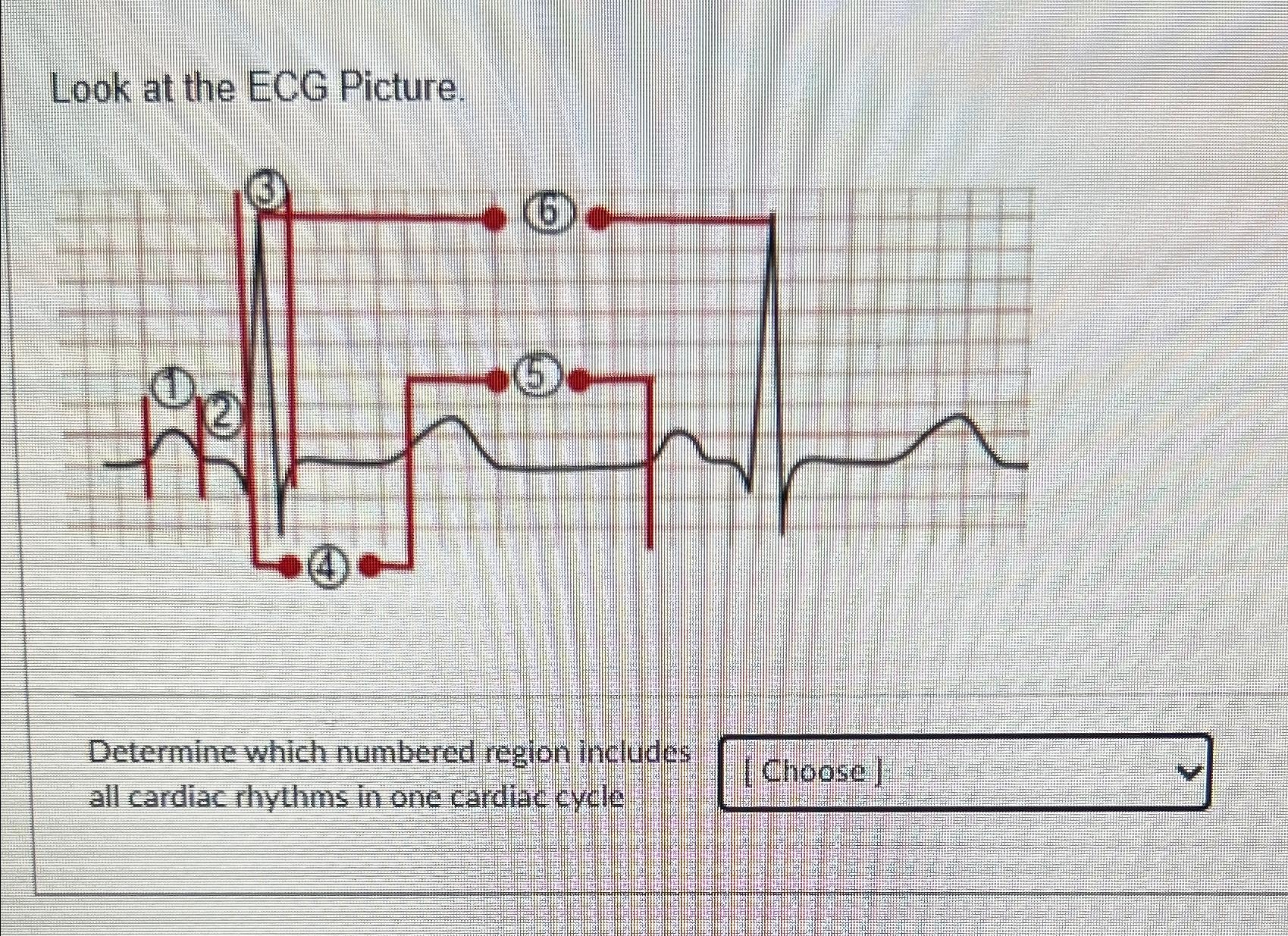 Solved Look at the ECG Picture.Determine which numbered | Chegg.com