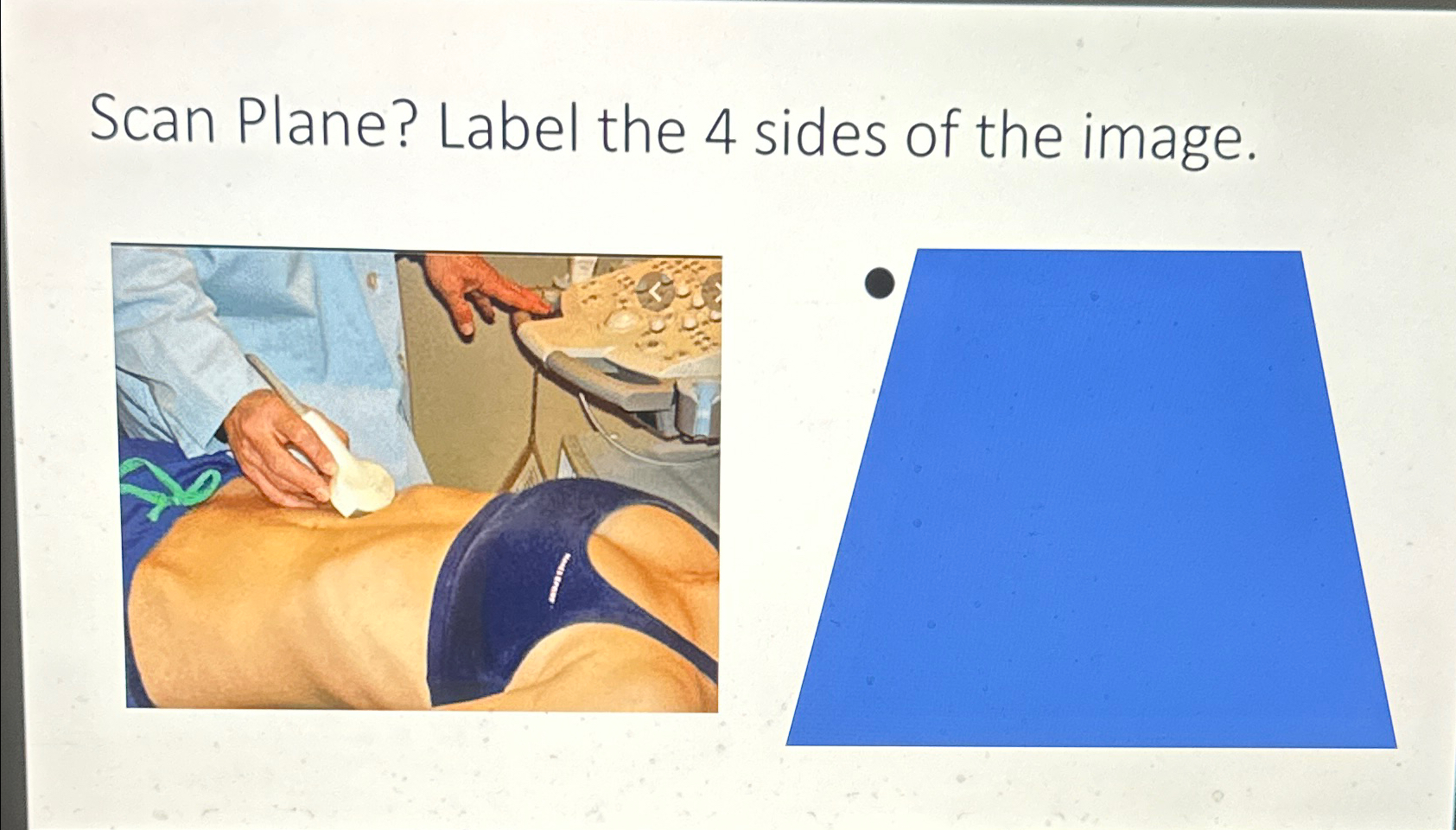 Solved Scan Plane? Label the 4 ﻿sides of the image. | Chegg.com