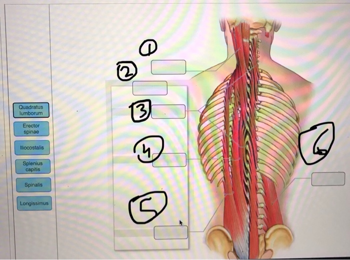 Solved Quadratus lumborum Erector spinae liocostalis | Chegg.com