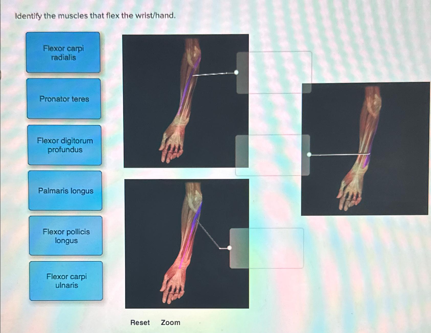 Solved Identify the muscles that flex the wrist/hand. | Chegg.com