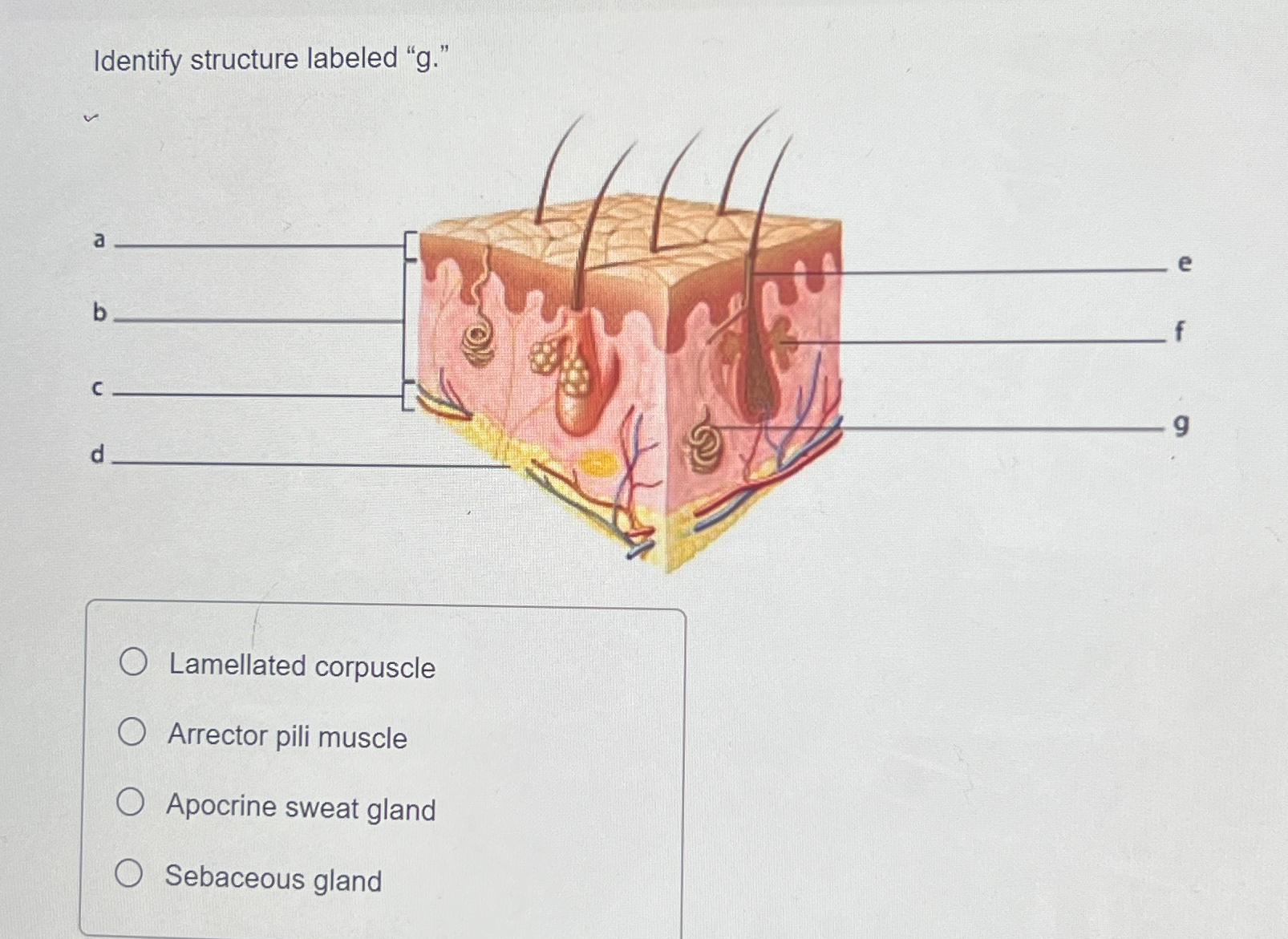 Solved Identify structure labeled "g."Lamellated | Chegg.com