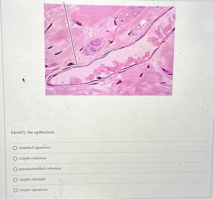 Solved Identify the epithelium. stratified squamous simple | Chegg.com