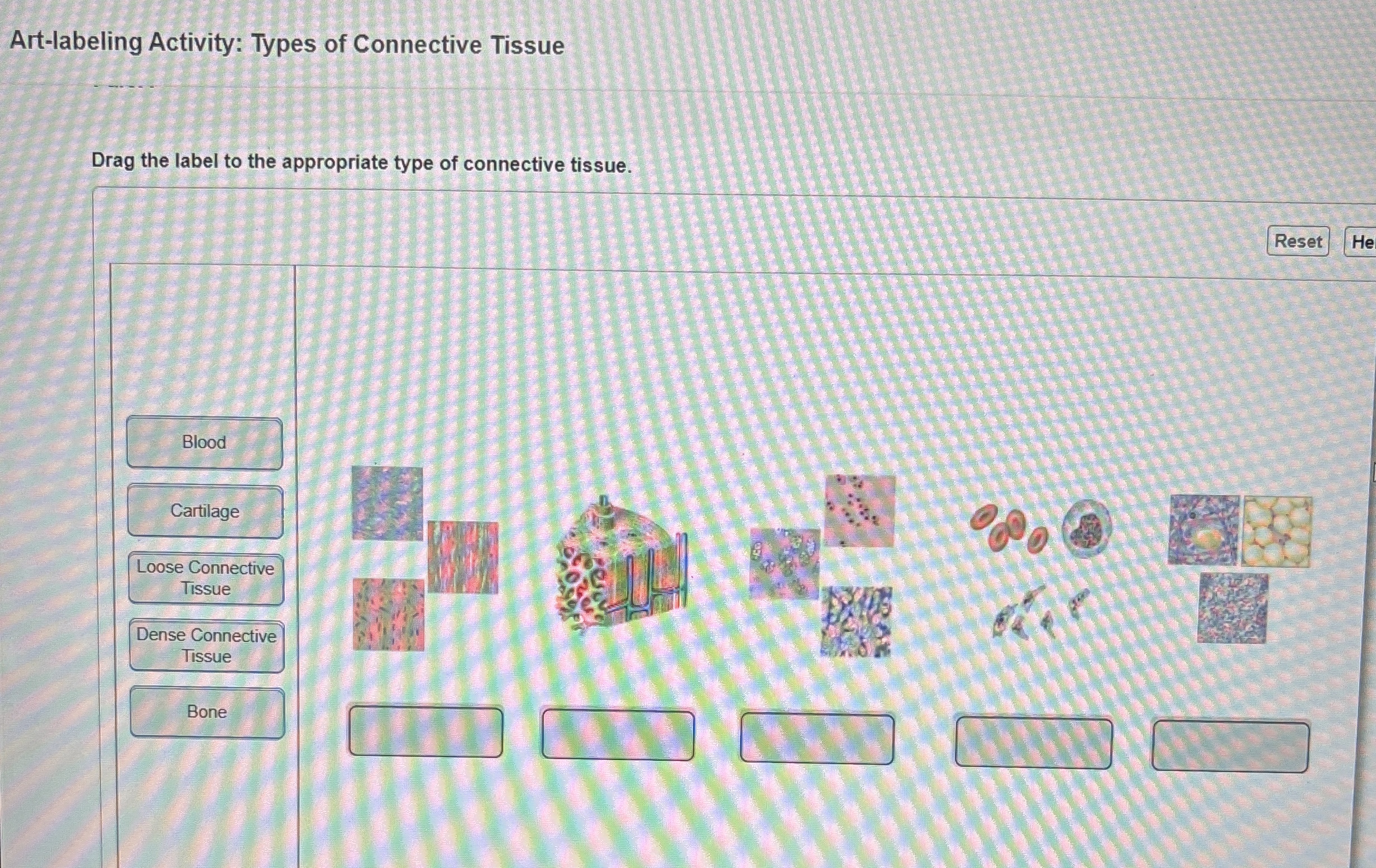 Solved Art-labeling Activity: Types of Connective TissueDrag | Chegg.com