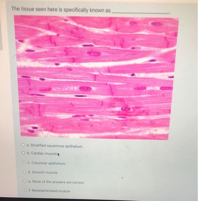 Solved Select one: O a. squamosal suture (squamous) b. | Chegg.com
