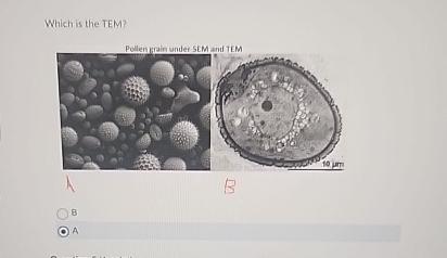 Solved Which is the TEM?8A | Chegg.com