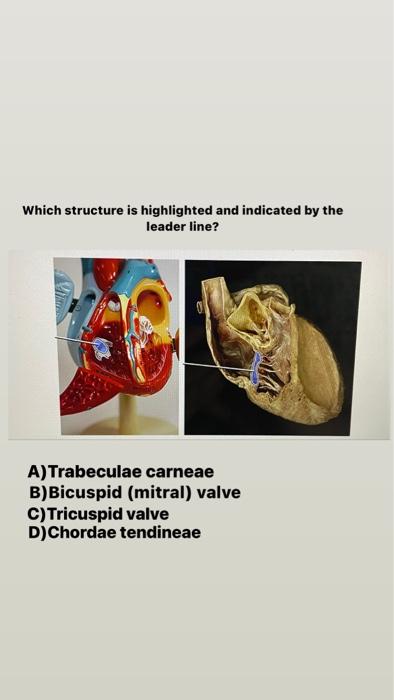 Solved What structure is highlighted and indicated by the | Chegg.com