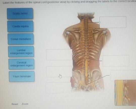 Solved Label the features or the spinal cord posterior view) | Chegg.com