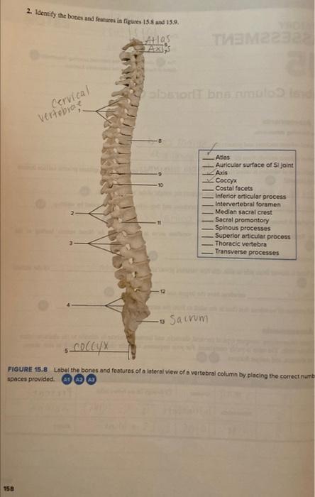 Solved 2. Identify the bones and features in figures 15.8 | Chegg.com