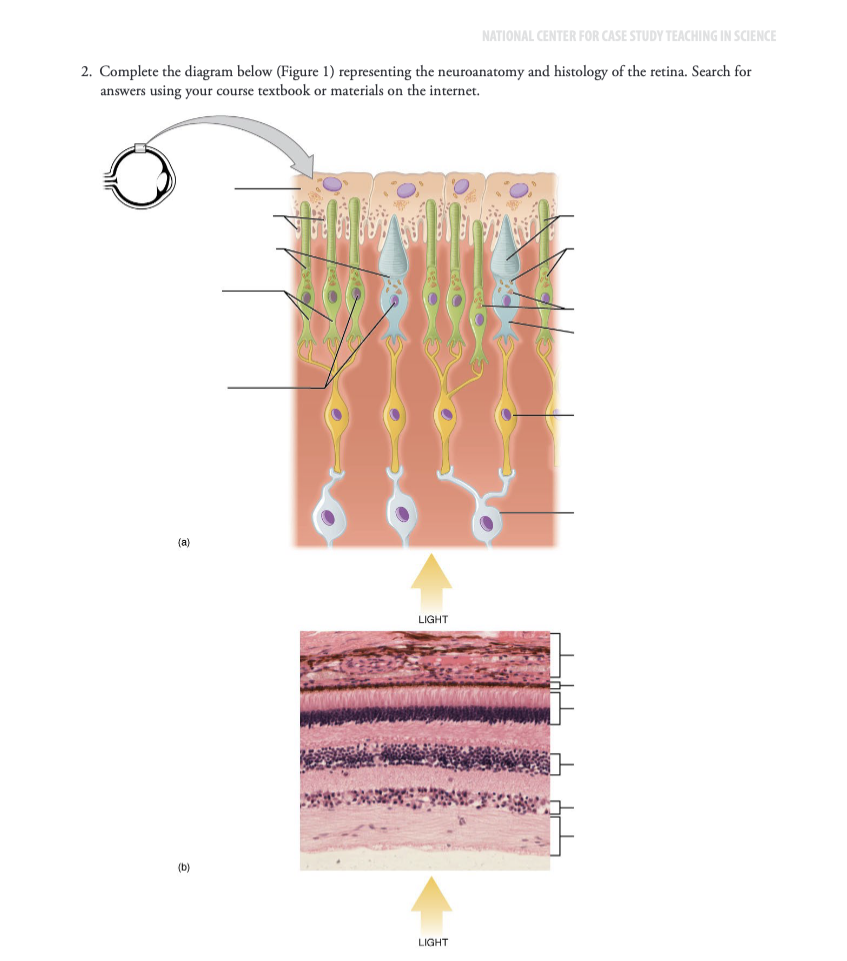 Solved Complete the diagram below (Figure 1) ﻿representing | Chegg.com