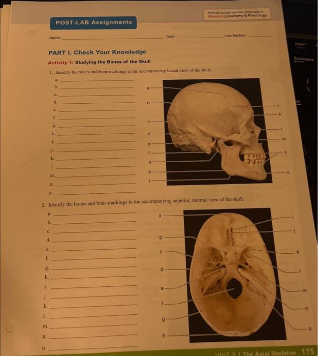 Solved 1. Identify the bones and bape markings in the | Chegg.com