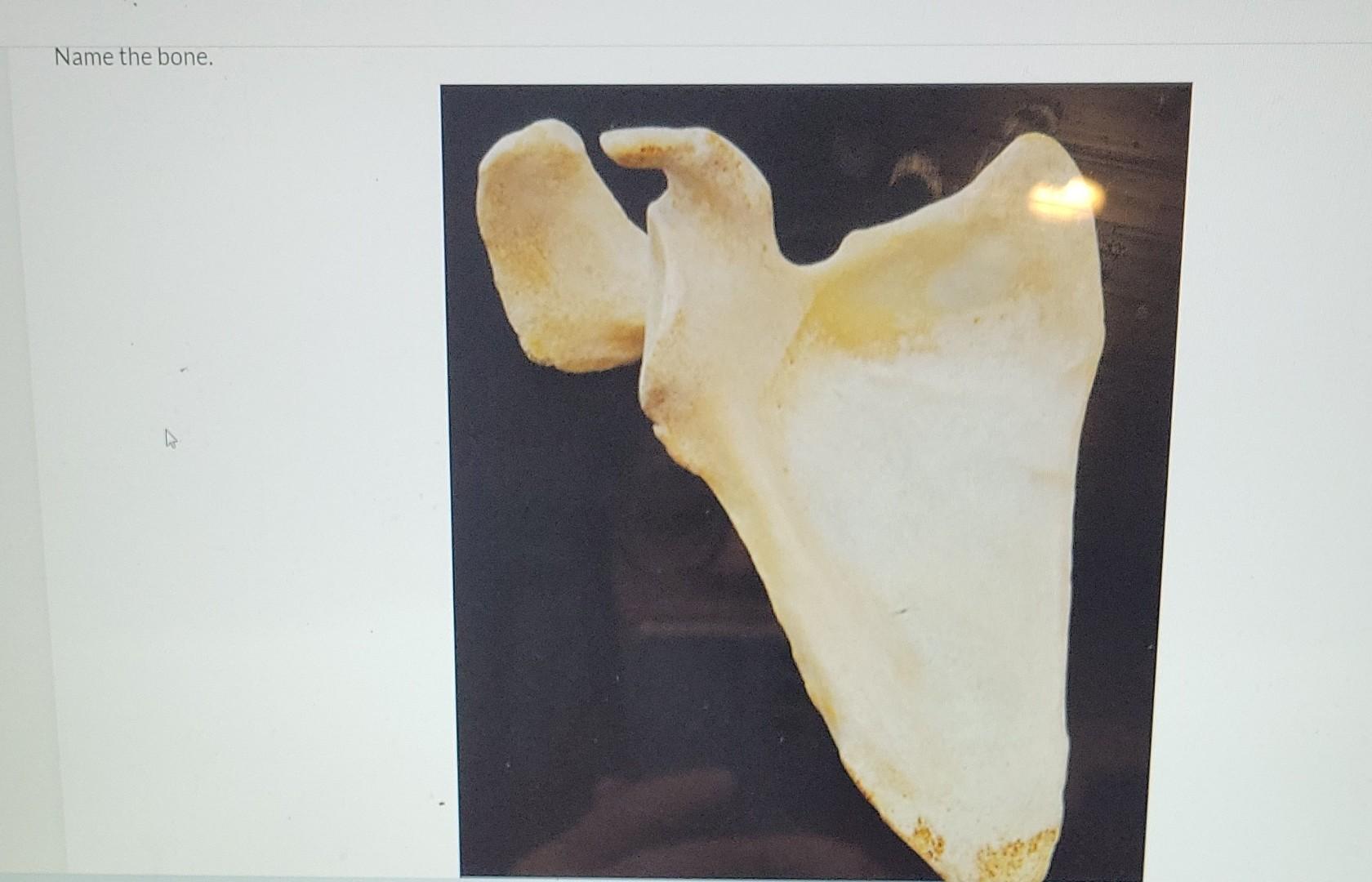 Solved Name the bone. 2 0.2 points Identify the bone. 3 | Chegg.com