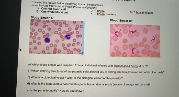 Solved Examine the figures below displaying human blood | Chegg.com