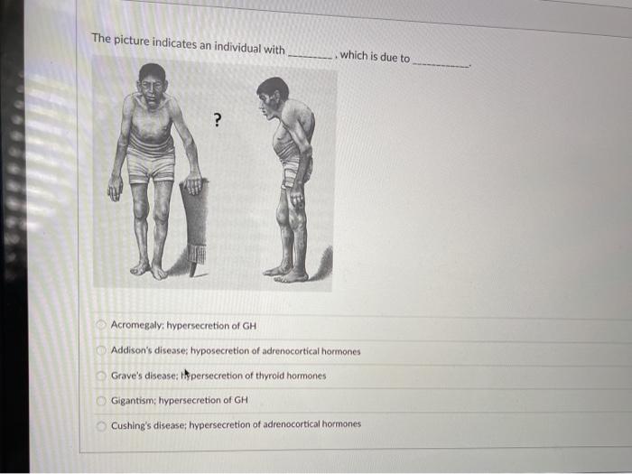 Solved The picture indicates an individual with which is due | Chegg.com