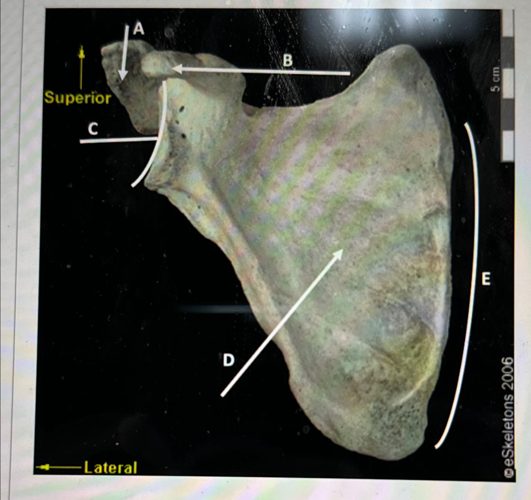 Solved Match the bone marking / ﻿structure with the correct | Chegg.com