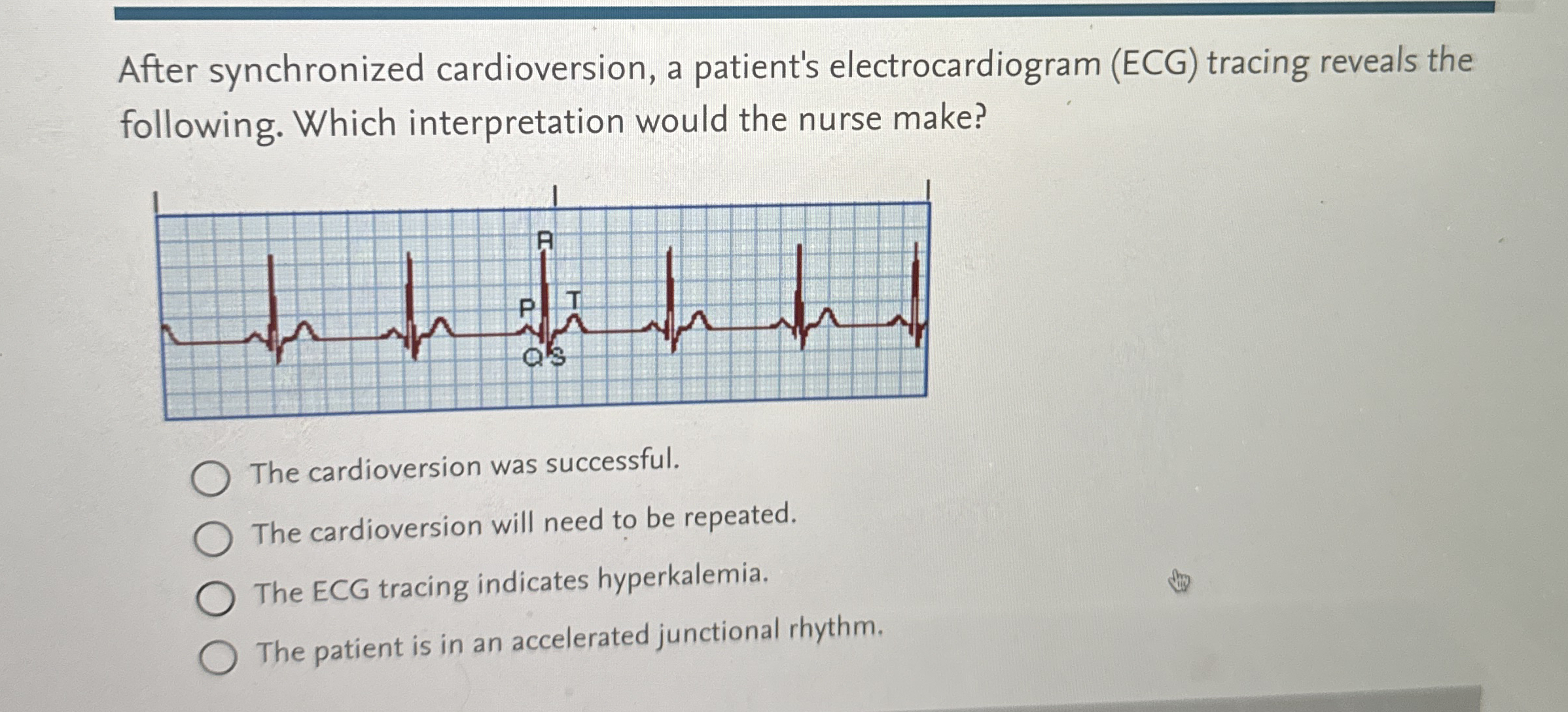 [Solved]: After synchronized cardioversion, a patient's