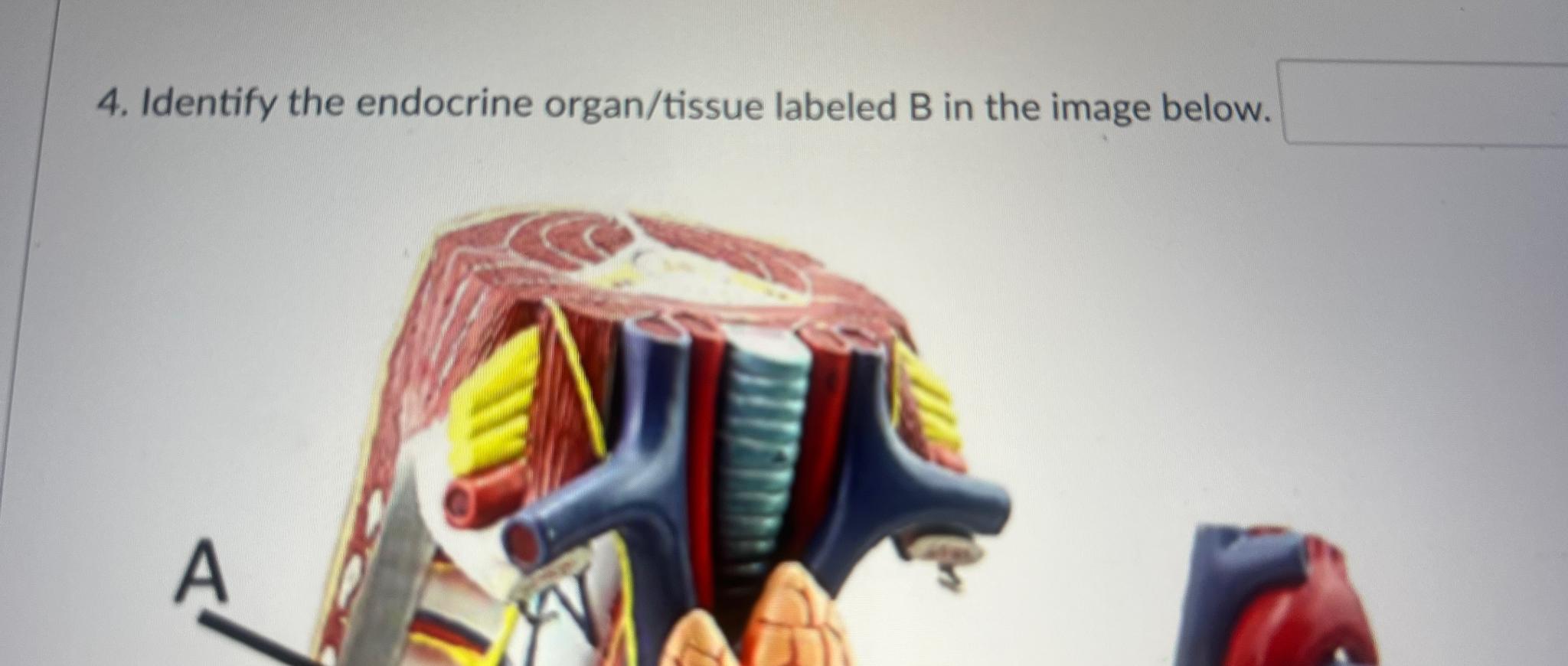 Solved Identify the endocrine organ/tissue labeled B in the | Chegg.com