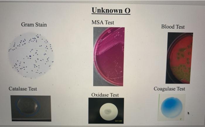 Solved 1 Name: Blo 230: Microbiology Date: Lab section: 12 | Chegg.com