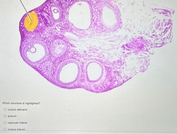 Which structure is highlighted? corpus albicans | Chegg.com