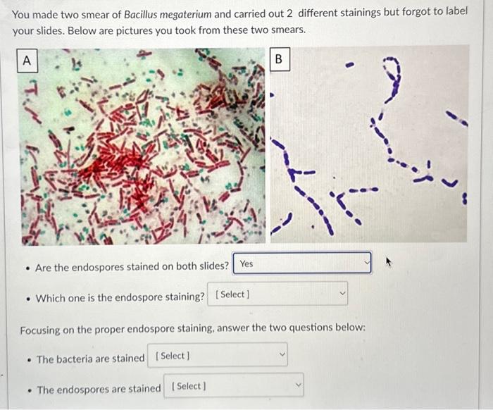 Solved You made two smear of Bacillus megaterium and carried | Chegg.com