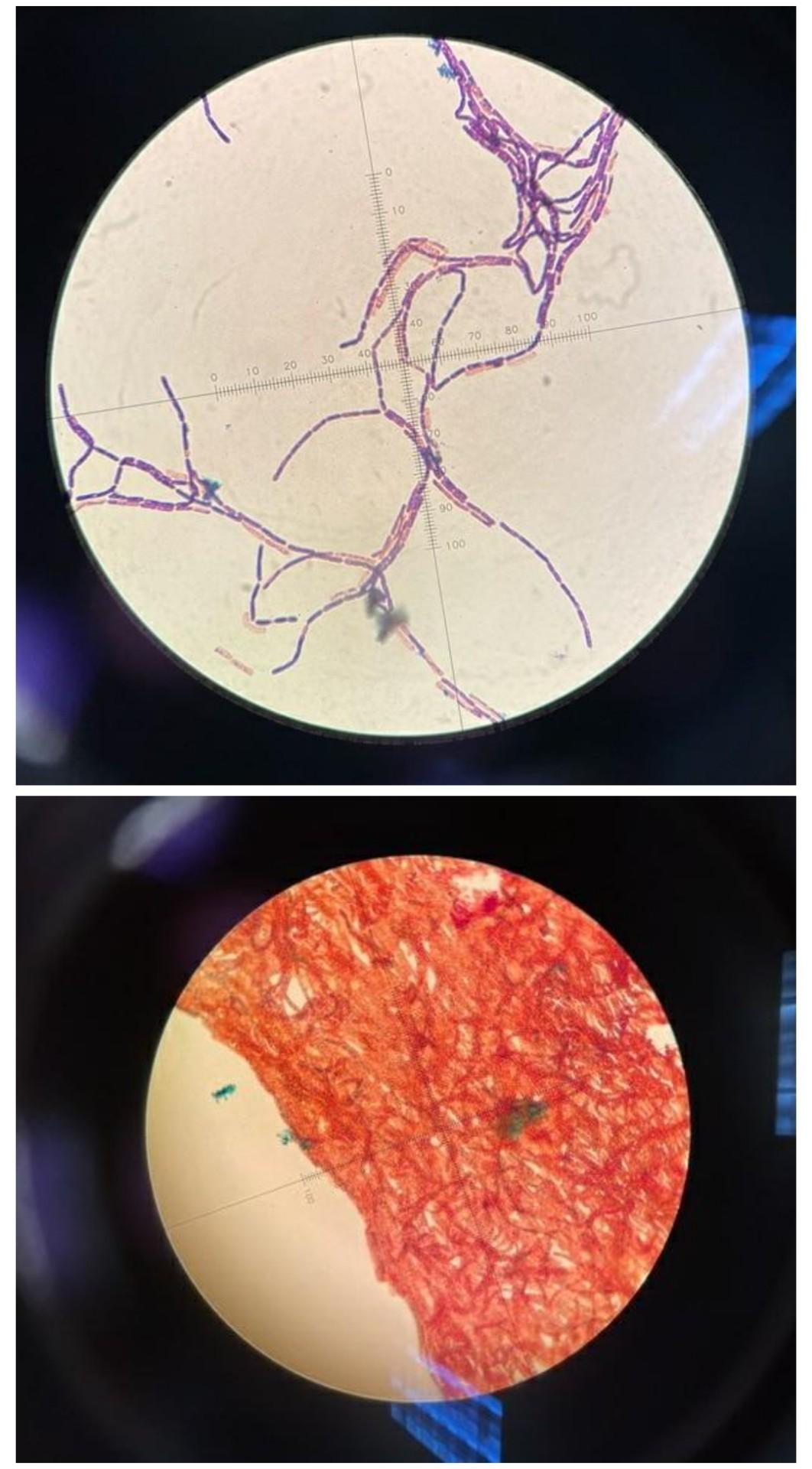 determine what your unknown bacteria is using the | Chegg.com