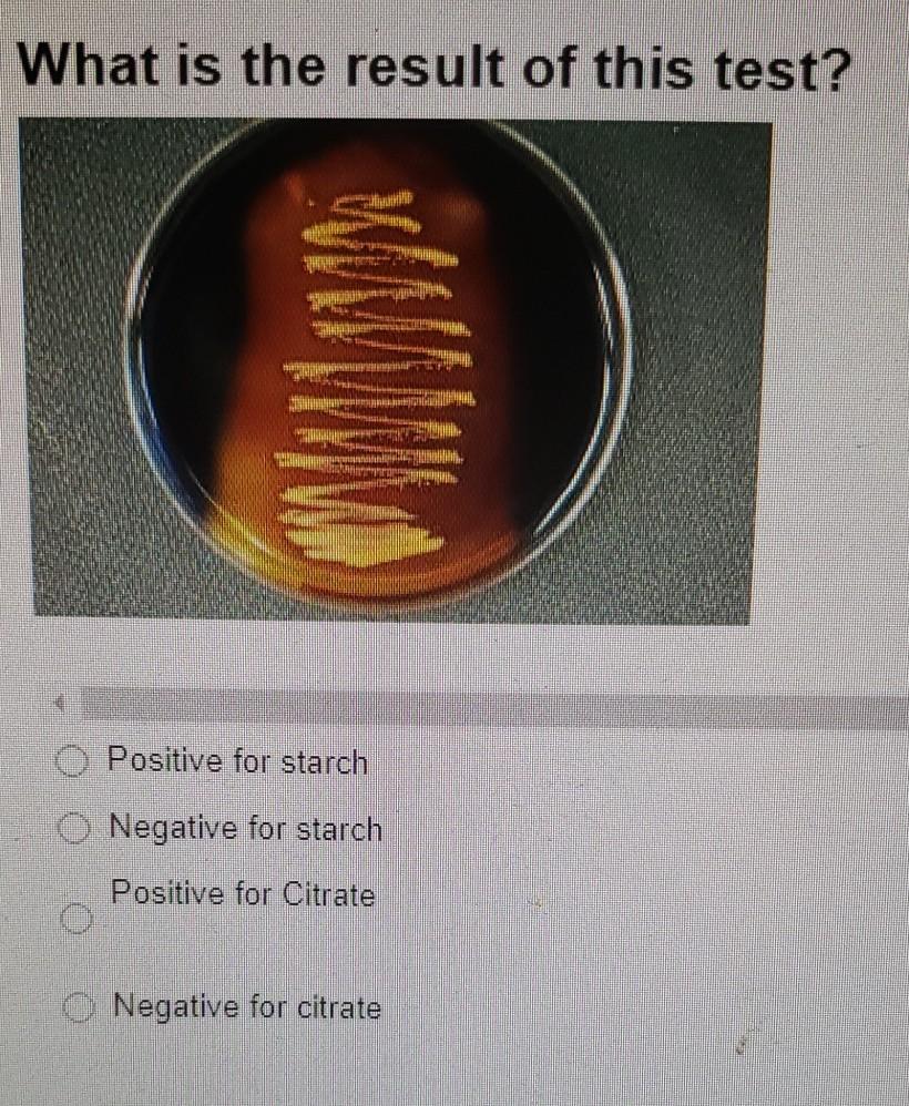 Solved What is the result of this test? Positive for starch | Chegg.com
