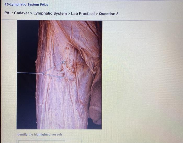 Solved Lymphatic | Chegg.com