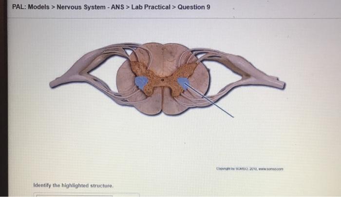 Solved PAL: Models > Nervous System - ANS > Lab Practical > | Chegg.com