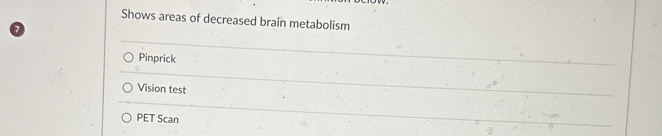 Solved Shows areas of decreased brain | Chegg.com