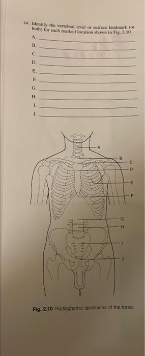 Solved 14. Identify the vertebral level of surface landmark | Chegg.com