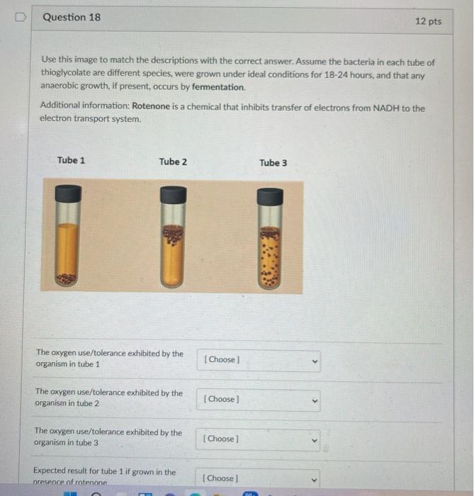 Solved Flasks A and B contain broth, and are inoculated with | Chegg.com