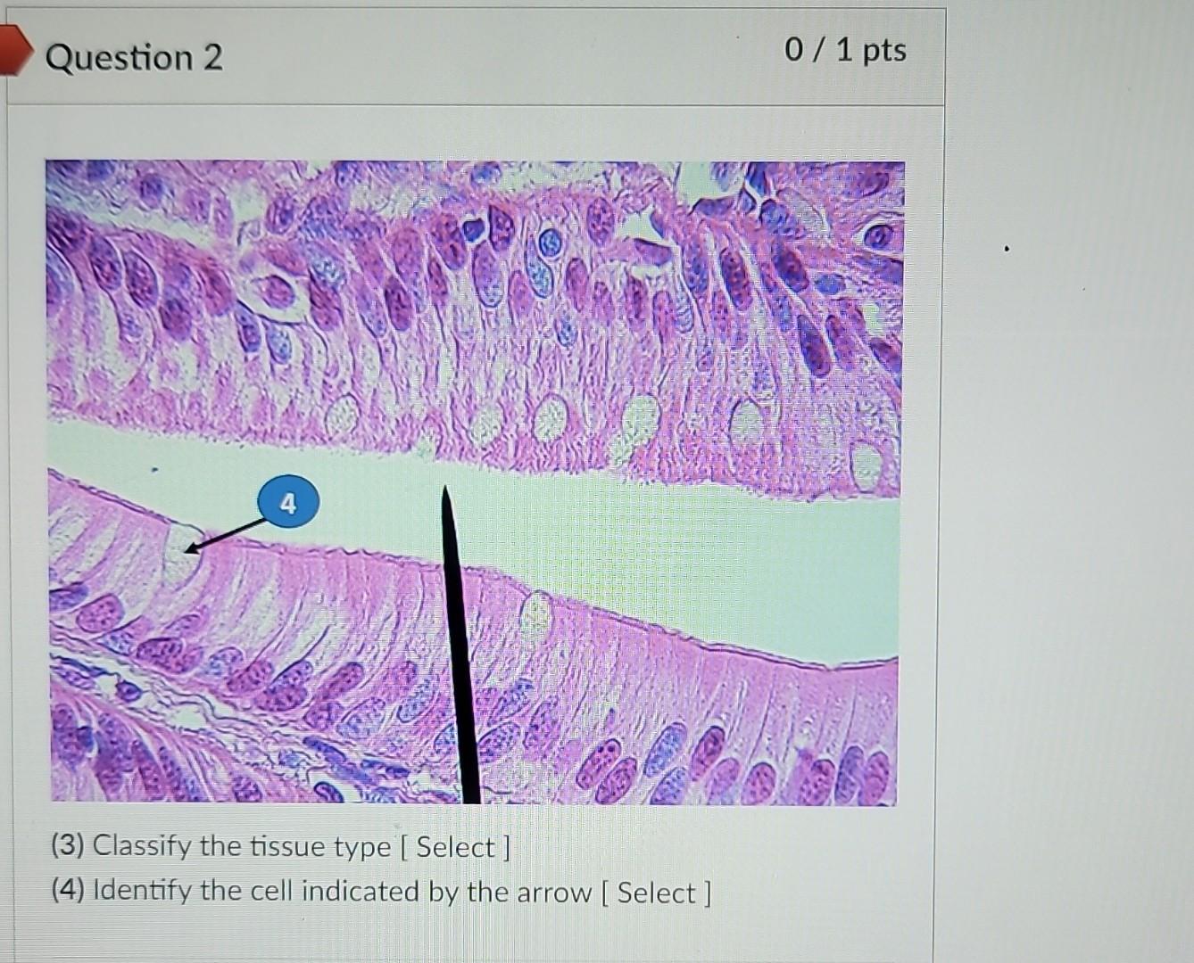 Solved (9) Classify the tissue type [ Select ] (10) Identify | Chegg.com
