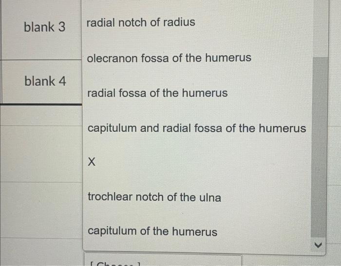 Complete the sentence below matching bone feature and | Chegg.com
