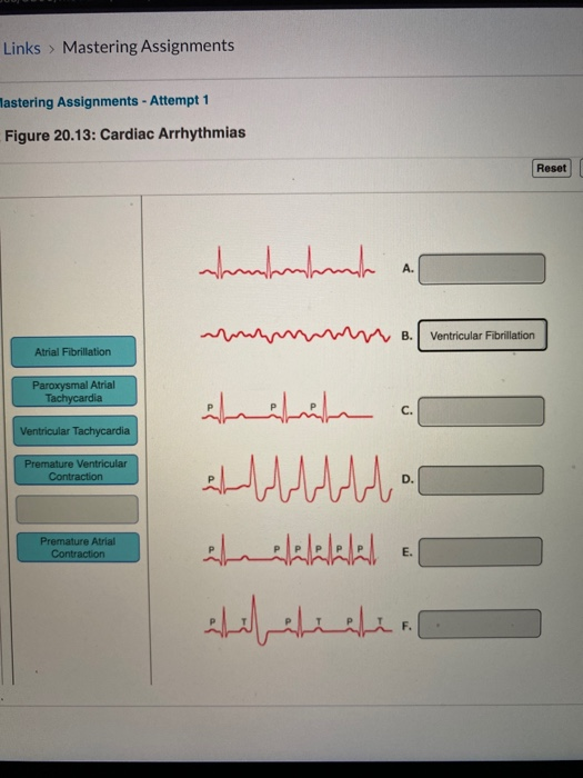 Solved Links > Mastering Assignments Mastering Assignments - | Chegg.com