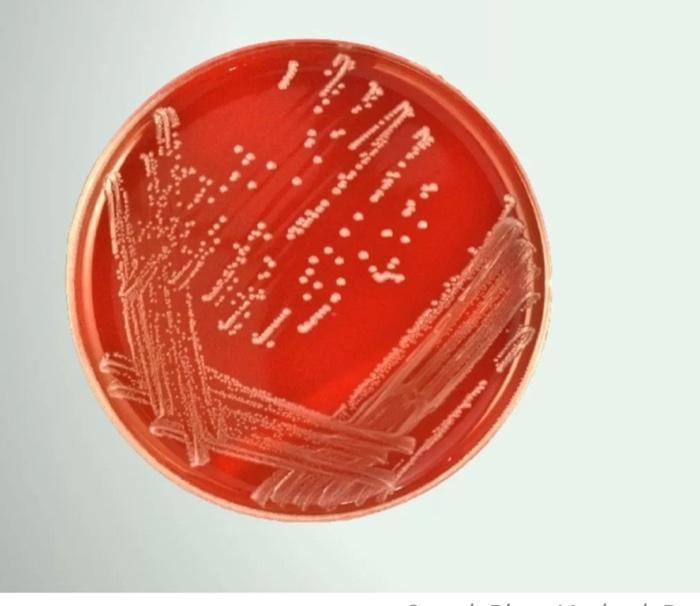 Solved 2 Questions: 1. Select a discrete colony. Describe | Chegg.com