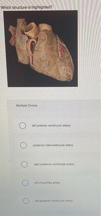 Solved Which structure is highlighted? Multiple Choice O | Chegg.com