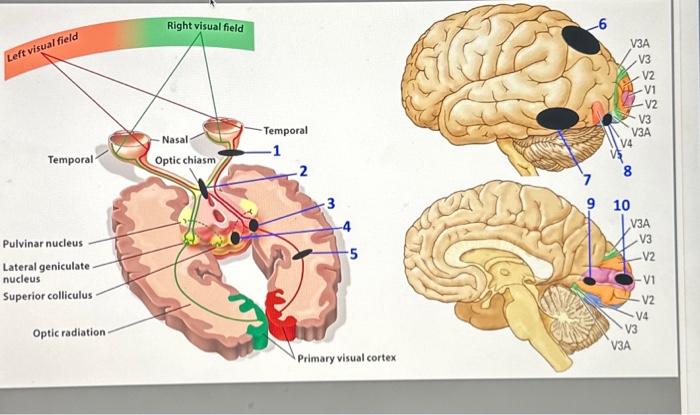 Solved In the figure you will see 10 regions of the visual | Chegg.com