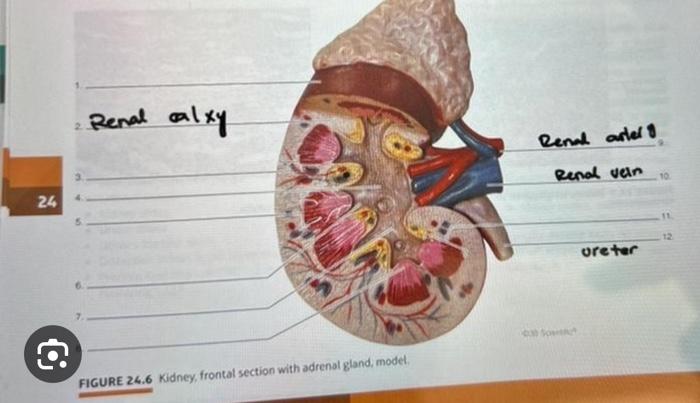 Solved FIGURE 24.6 Kidney, frontal section with adrenal | Chegg.com