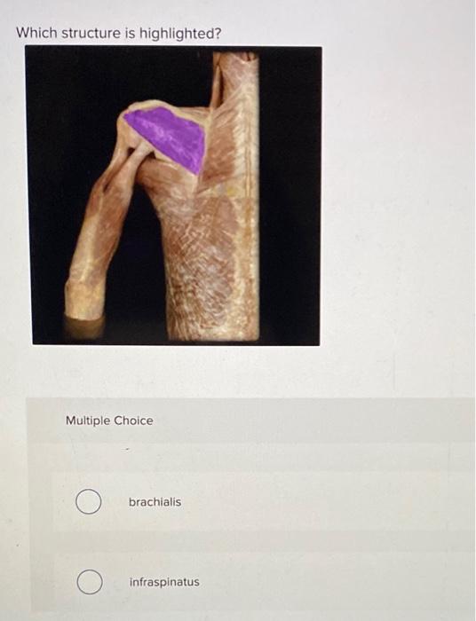 Solved Which structure is highlighted? Multiple Choice | Chegg.com