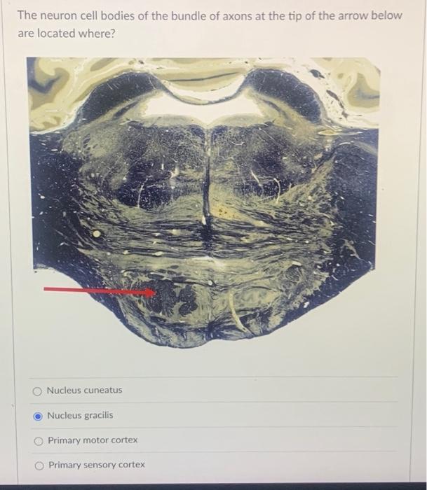 The neuron cell bodies of the bundle of axons at the | Chegg.com