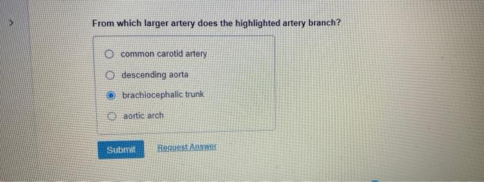 Solved From which larger artery does the highlighted | Chegg.com