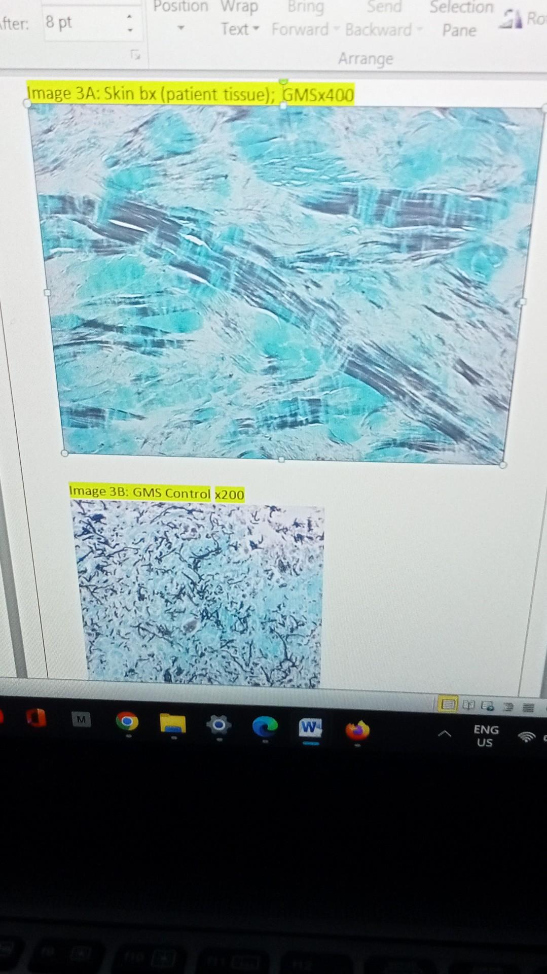 Solved Question 3A: Examine the Image 3A together with the | Chegg.com