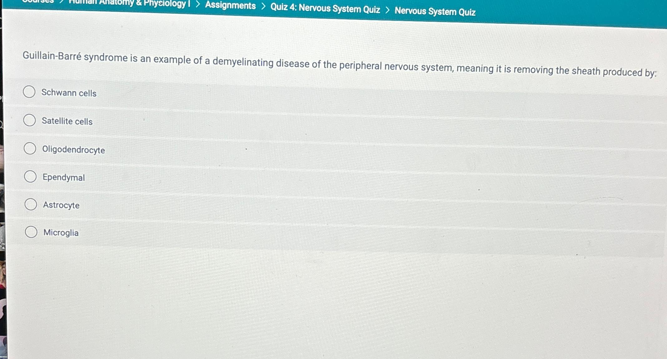 Solved Guillain-Barré ﻿syndrome is an example of a | Chegg.com