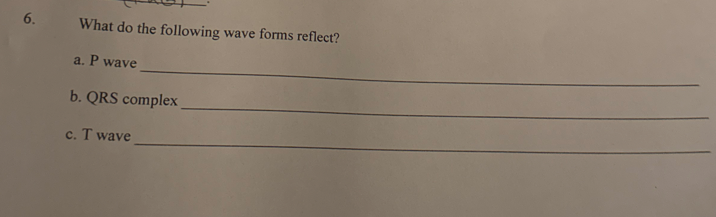 Solved What do the following wave forms reflect?a. P ﻿wave | Chegg.com