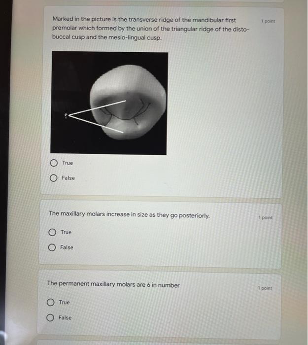 Solved 1 point Marked in the picture is the transverse ridge | Chegg.com