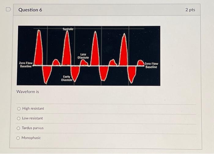 Waveform is High resistant Low resistant Tardus | Chegg.com