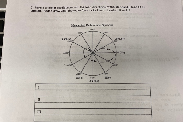 Solved 3. Here's a vector cardiogram with the lead | Chegg.com