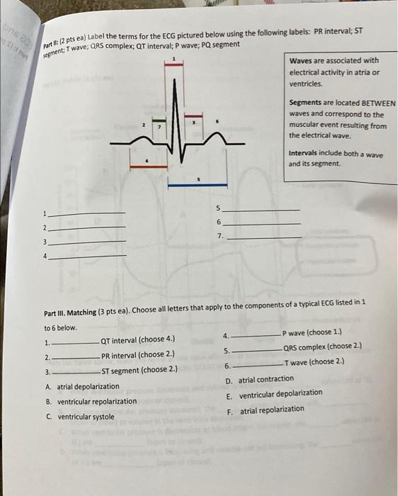 Solved ECG and BP Lab Part 1: (2 pts ea) Label the following | Chegg.com